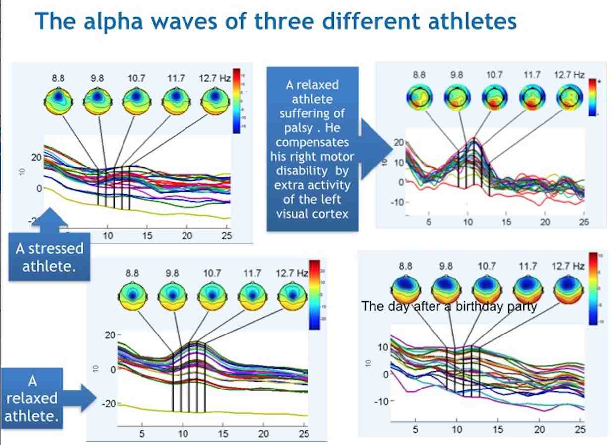 Human Waves - ondes alpha cerveau Athlètes • Regional-IT · Toute l ...