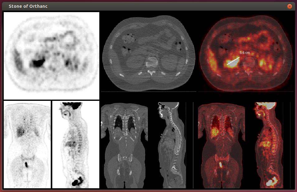 imagerie médicale - image Dicom - source- Orthanc Osimis • Regional-IT ...